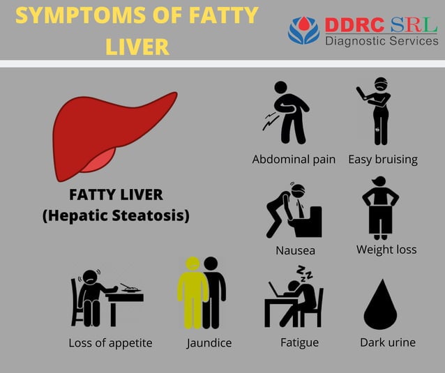 Symptoms Of Fatty Liver (Hepatic Steatosis)