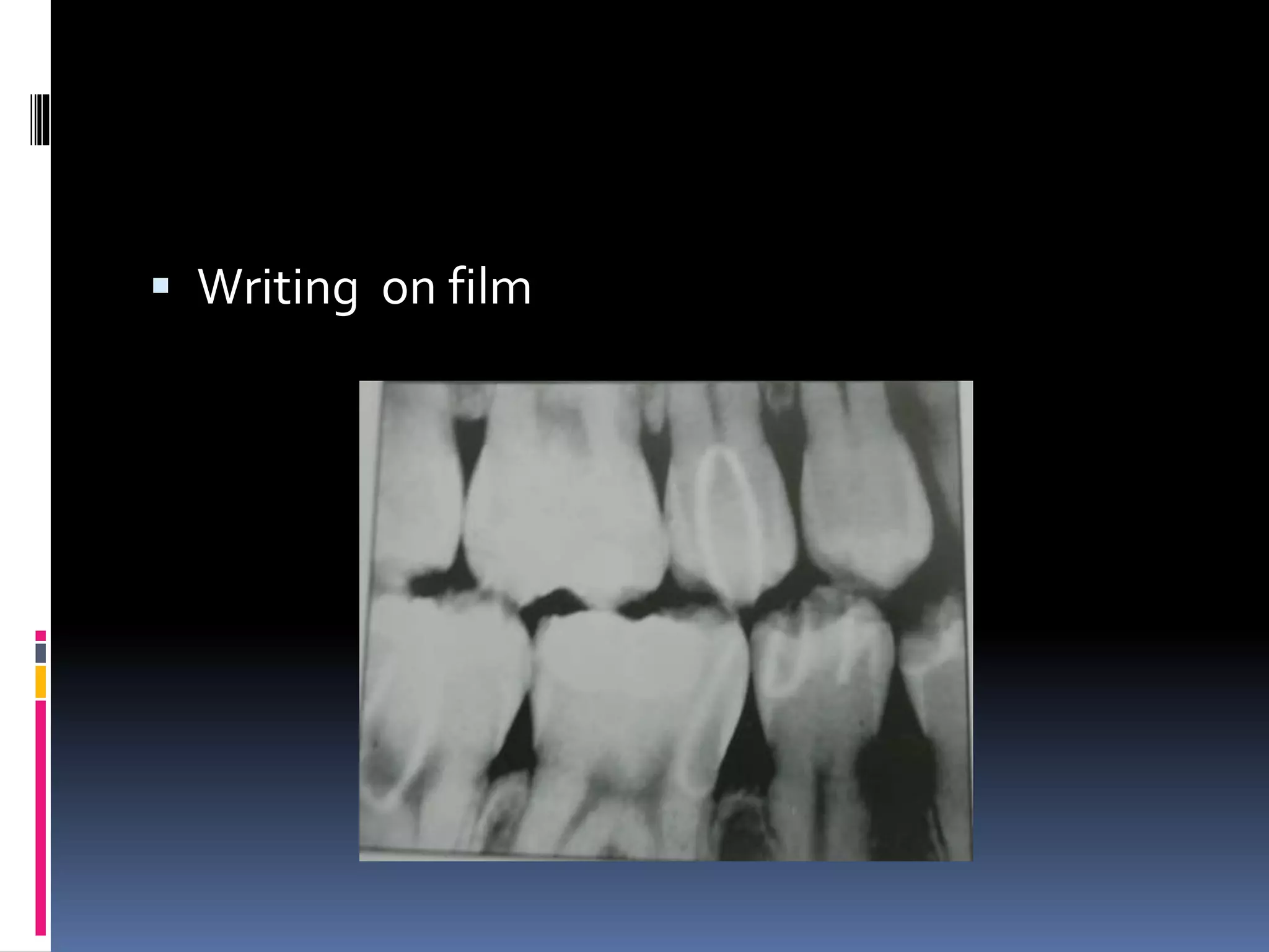 Faulty radiographs | PPTX
