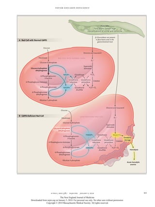 Favism and Glucose-6-Phosphate Dehydrogenase Deficiency.pdf