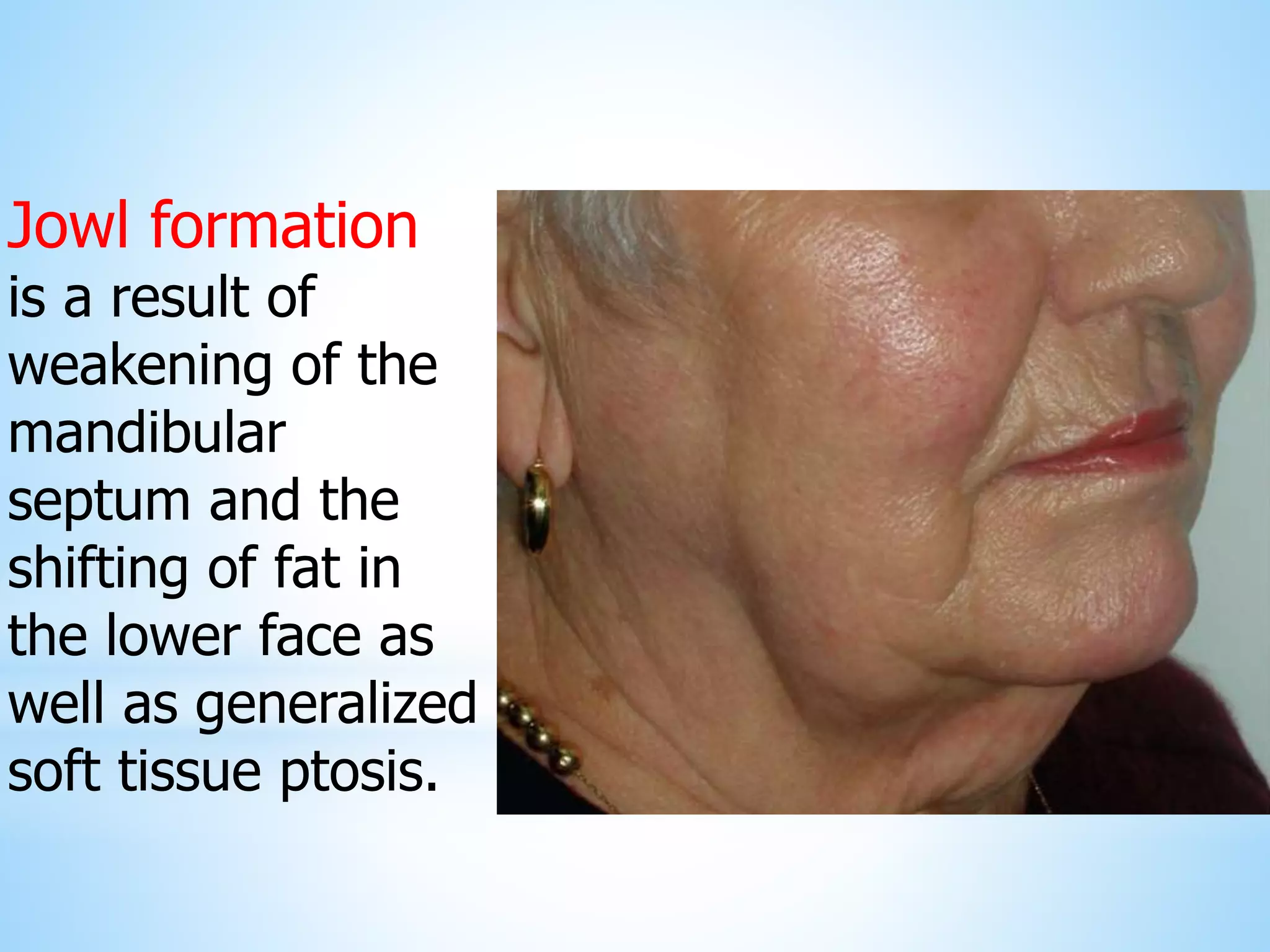 Fawzy a fat compartments and retaining ligaments of the face | PPTX
