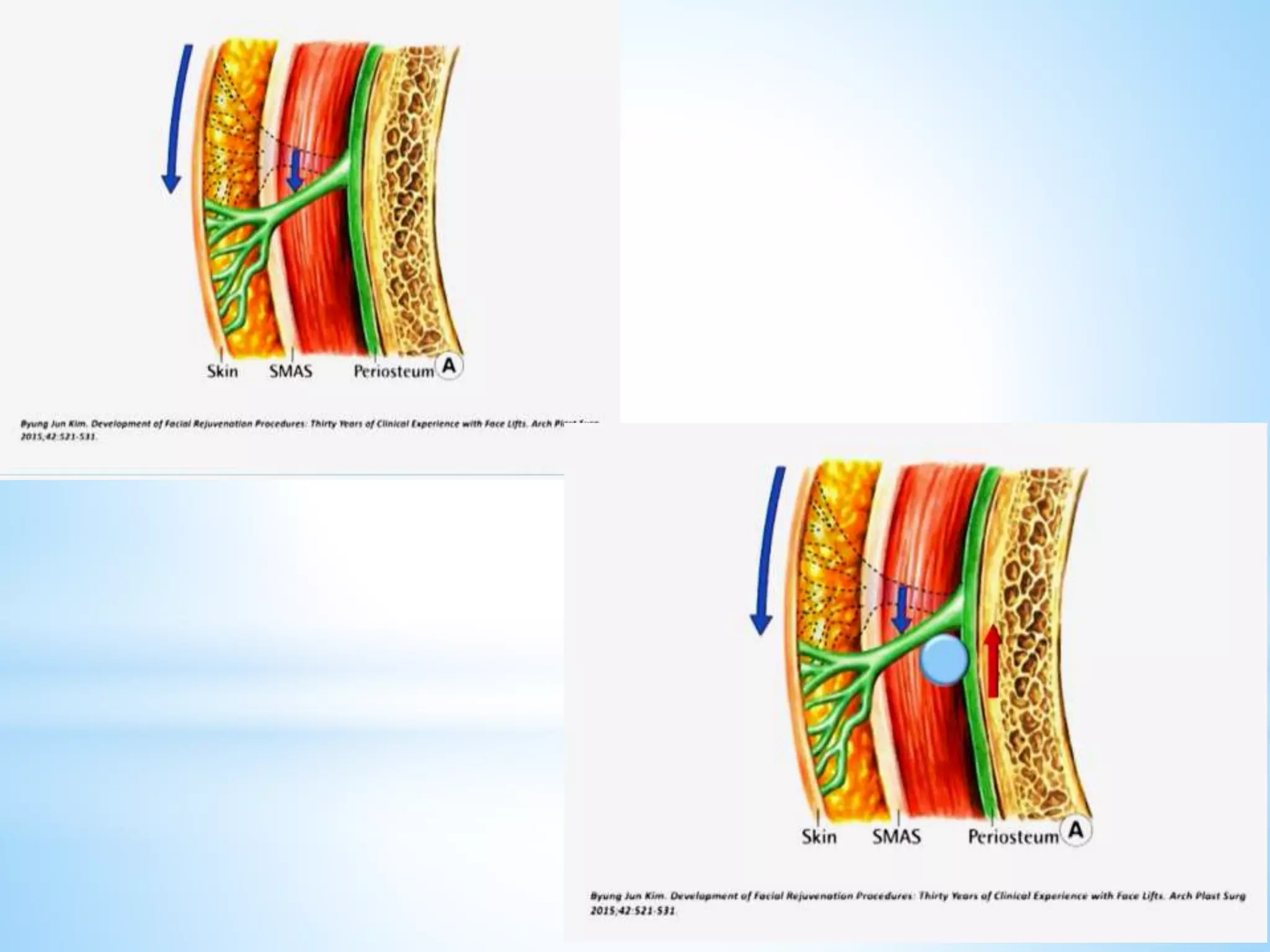 Fawzy a fat compartments and retaining ligaments of the face | PPTX