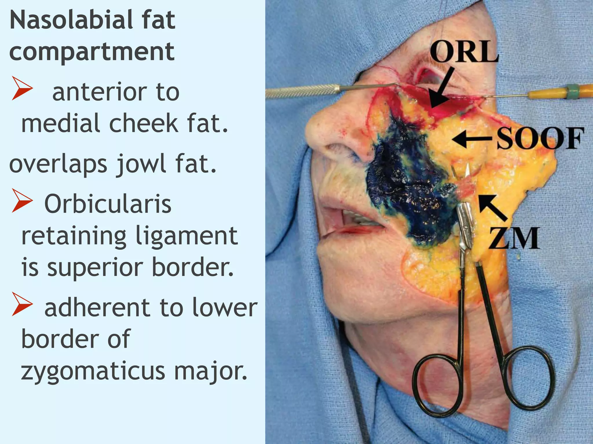Fawzy a fat compartments and retaining ligaments of the face | PPTX