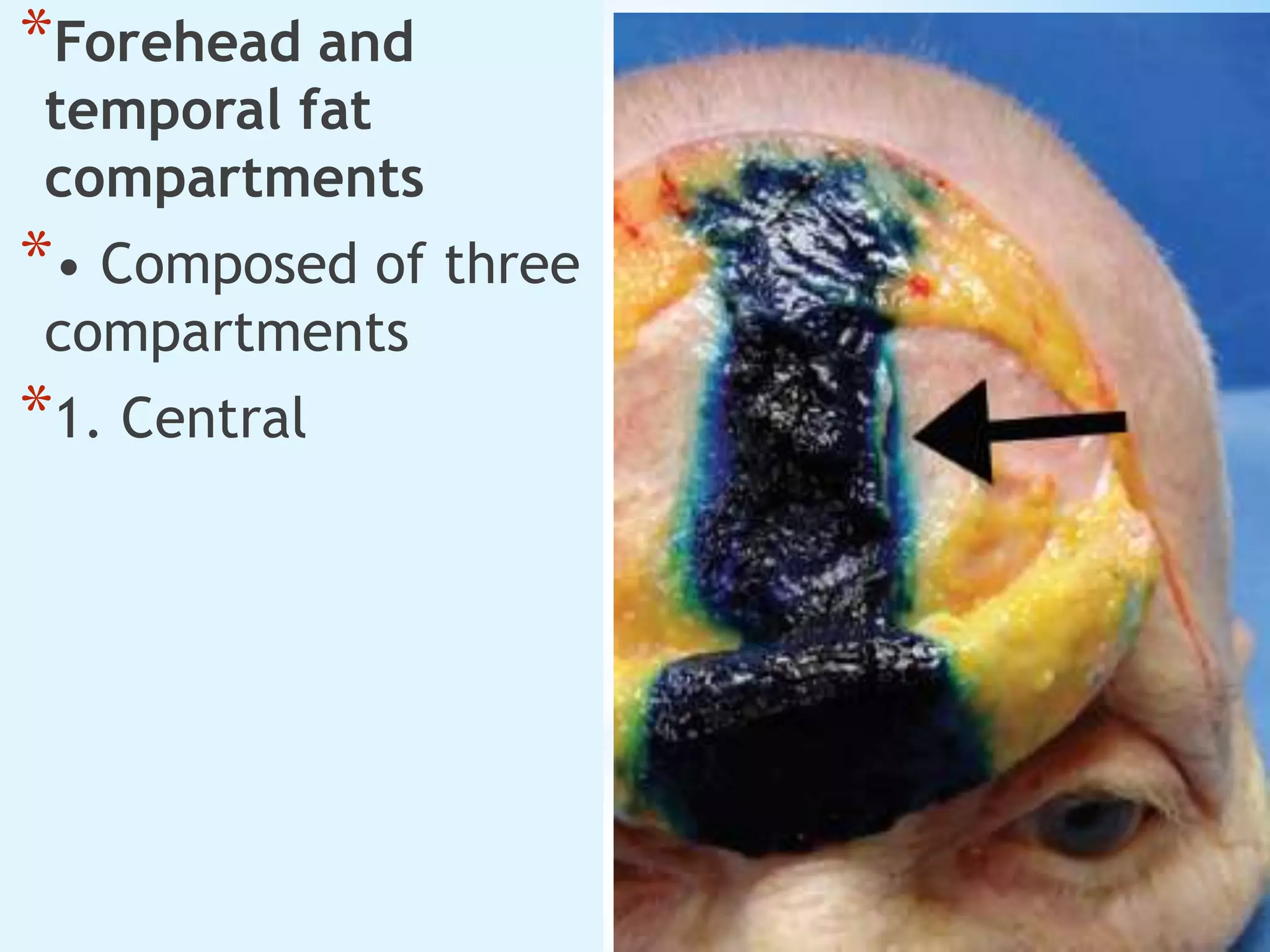 Fawzy a fat compartments and retaining ligaments of the face | PPTX