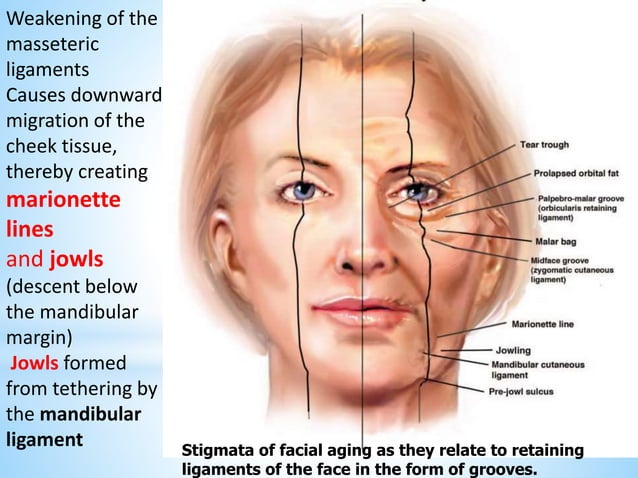 Fawzy a fat compartments and retaining ligaments of the face | PPTX