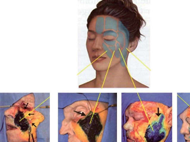 Fawzy a fat compartments and retaining ligaments of the face | PPTX