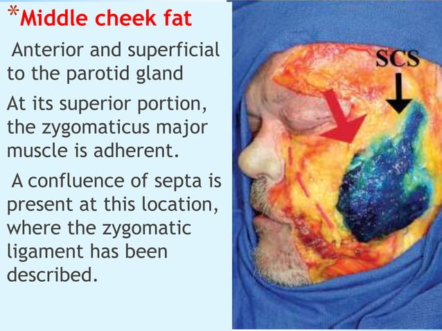 Fawzy a fat compartments and retaining ligaments of the face | PPTX