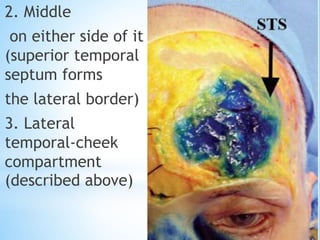 Fawzy a fat compartments and retaining ligaments of the face | PPTX
