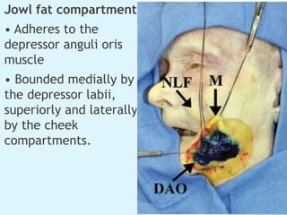 Fawzy a fat compartments and retaining ligaments of the face | PPTX