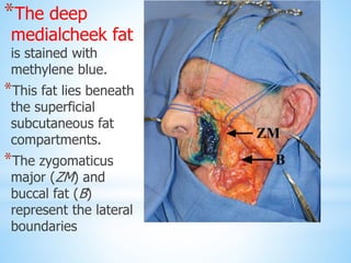 Fawzy a fat compartments and retaining ligaments of the face | PPTX