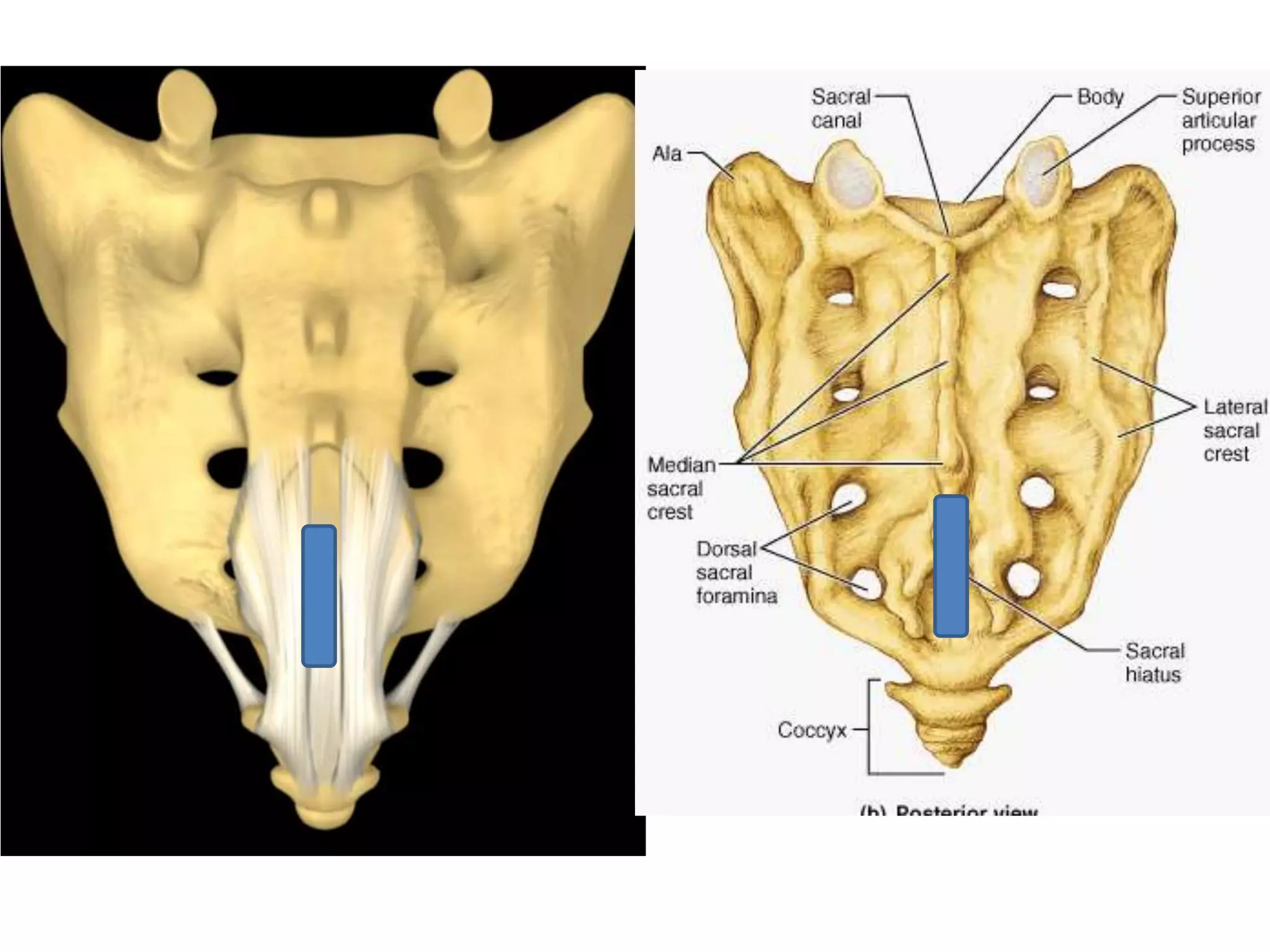 Basic sonoanatomy of ultrasound guided interventions of cervical and ...