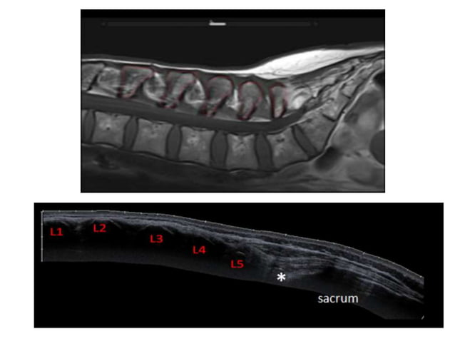 Basic sonoanatomy of ultrasound guided interventions of cervical and ...