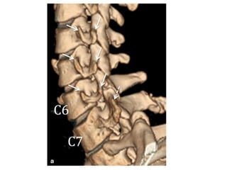 Basic sonoanatomy of ultrasound guided interventions of cervical and ...