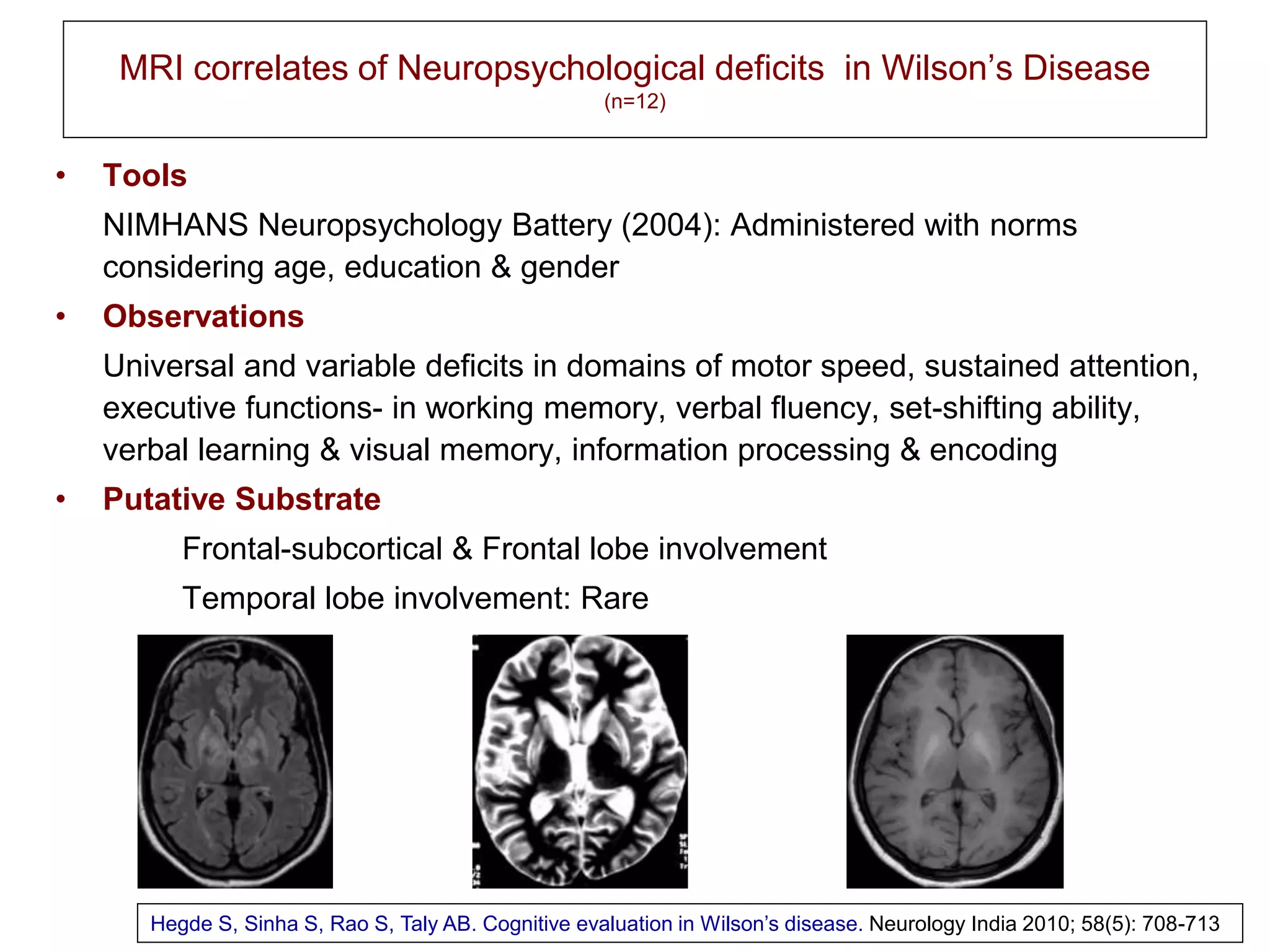 Role of MRI in Wilson disease - Dr Sanjib Sinha | PPTX