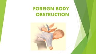 FOREIGN BODY OBSTRUCTION | PPTX