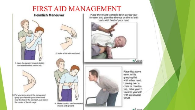 FOREIGN BODY OBSTRUCTION | PPTX