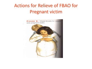 Fbao management | PPT