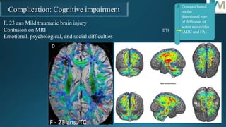 TRAUMATIC BRAIN INJURY - F. Benoudiba, JL Sarrazin | PPT