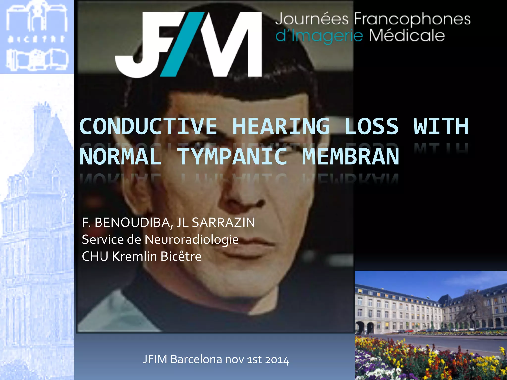 F benoudiba jl sarrazin transmissional hearing loss with normal ...