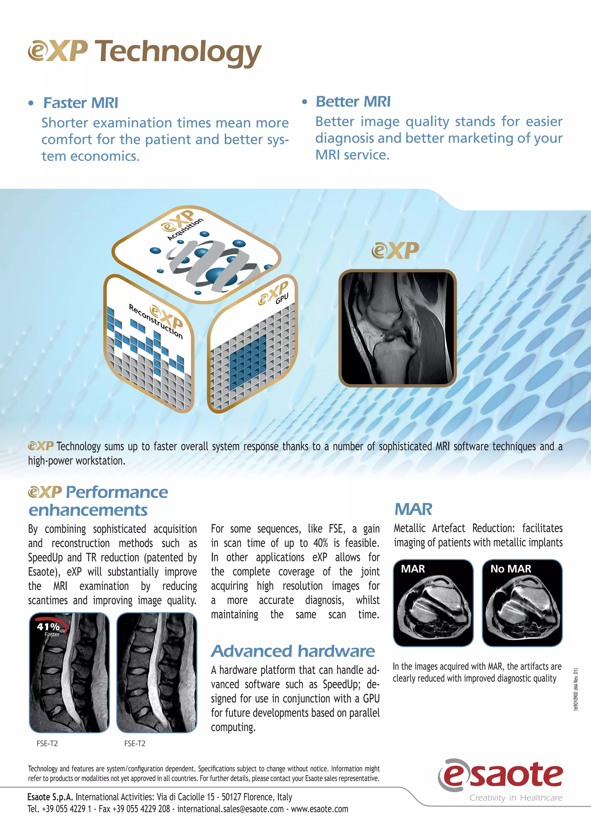 EXP Technology - Esaote MRI | PDF