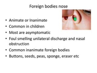 fb nose.ppt useful for bds and mbbs students | PPT