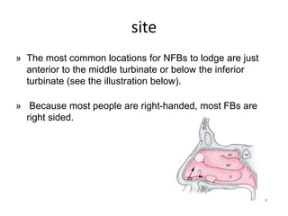 fb nose.ppt useful for bds and mbbs students | PPT