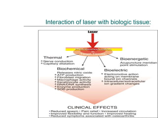 Laser On Soft Tissue. | PPT | Death, Injury, or Military Conflict ...