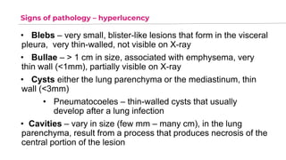 Imaging of Chest patholgy Radiology 2024 | PDF