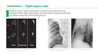 Imaging of Chest patholgy Radiology 2024 | PDF