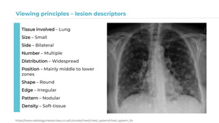 Imaging of Chest patholgy Radiology 2024 | PDF