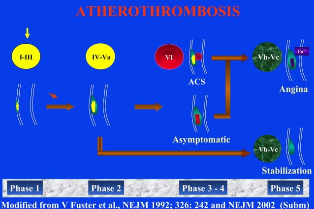 Atherothrombosis | PPT | Heart and Cardiovascular Diseases | Diseases ...