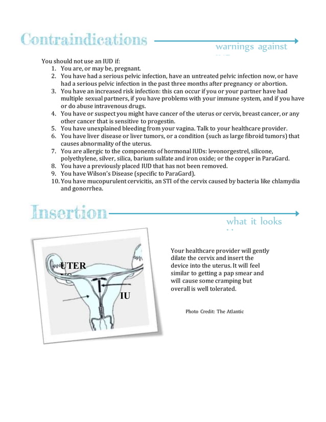 IUD Information Sheet | PDF
