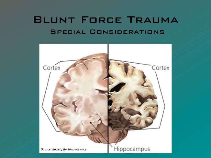 FCA 0111 - Blunt Force Trauma