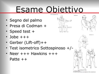 Caso clinico di riparazione cuffia dei rotatori | PPT