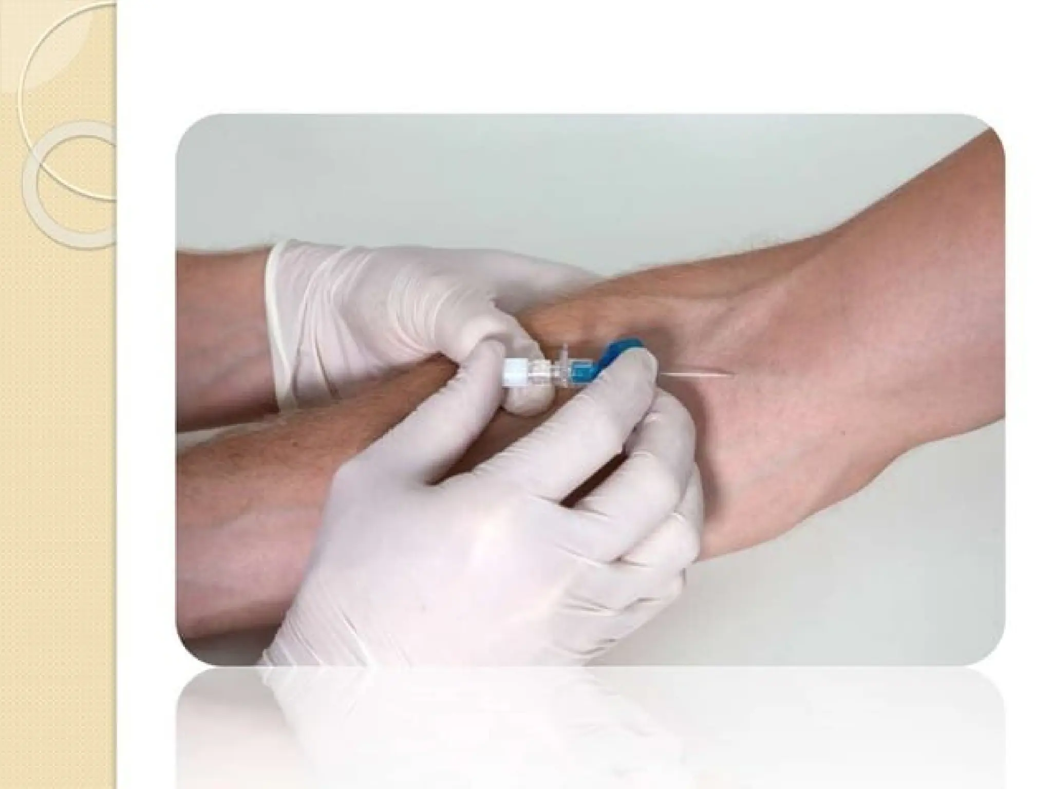 IV Cannulation and techniques and complications.pptx