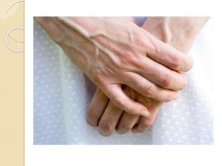 IV Cannulation and techniques and complications.pptx