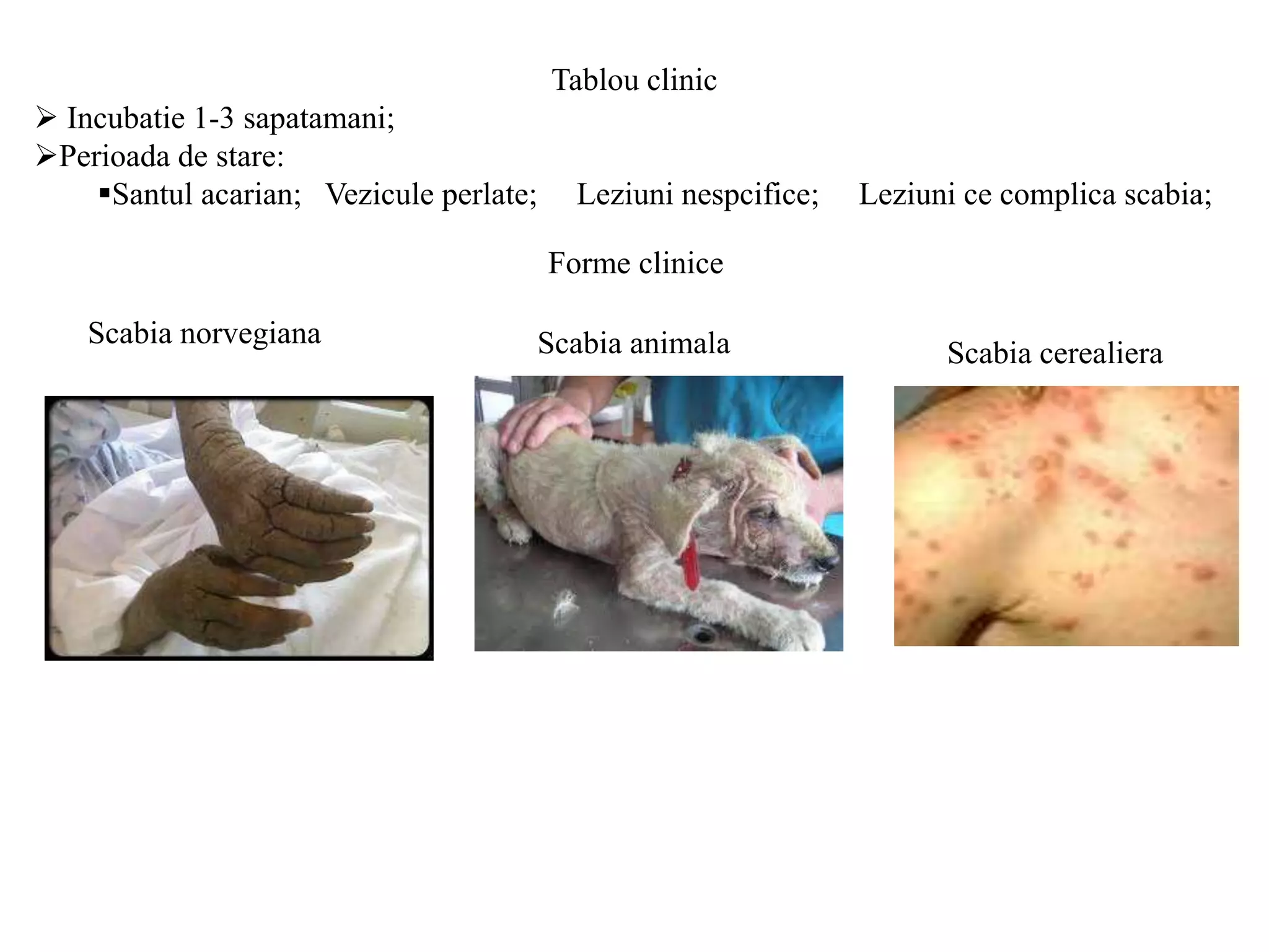 Partajare_pediculoza_scabie.pptx