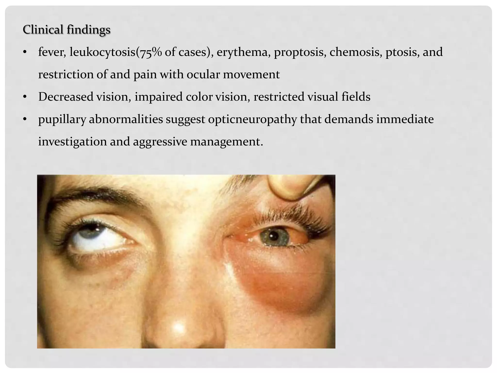 Bacterial_ocular_infections.pptx