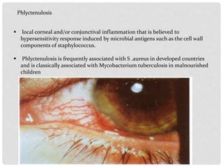 Bacterial_ocular_infections.pptx