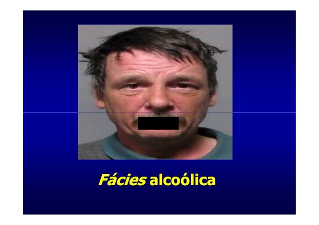 Fácies - Profa. Rilva Muñoz