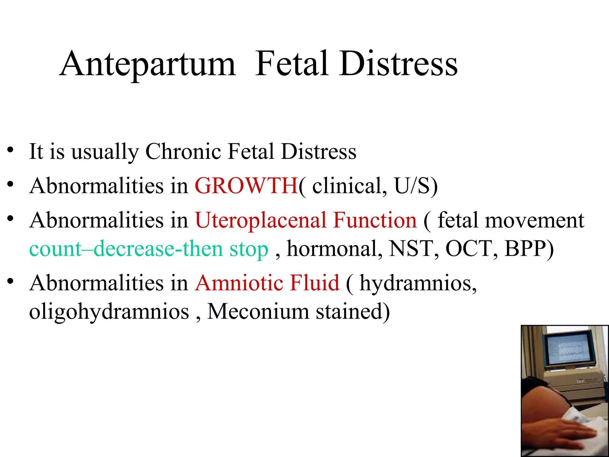 Fetal distress | PPS | Pregnancy | Reproductive Health