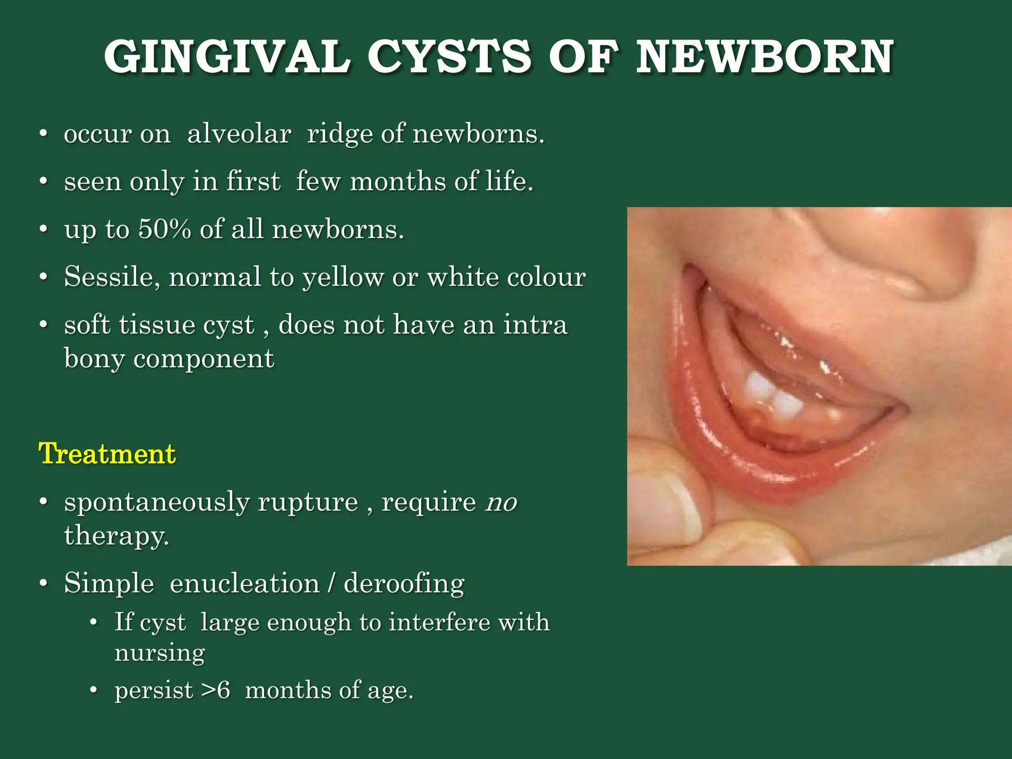 swelling_of_jaw_and_surgery_of_mandible_my_ppt.pptx