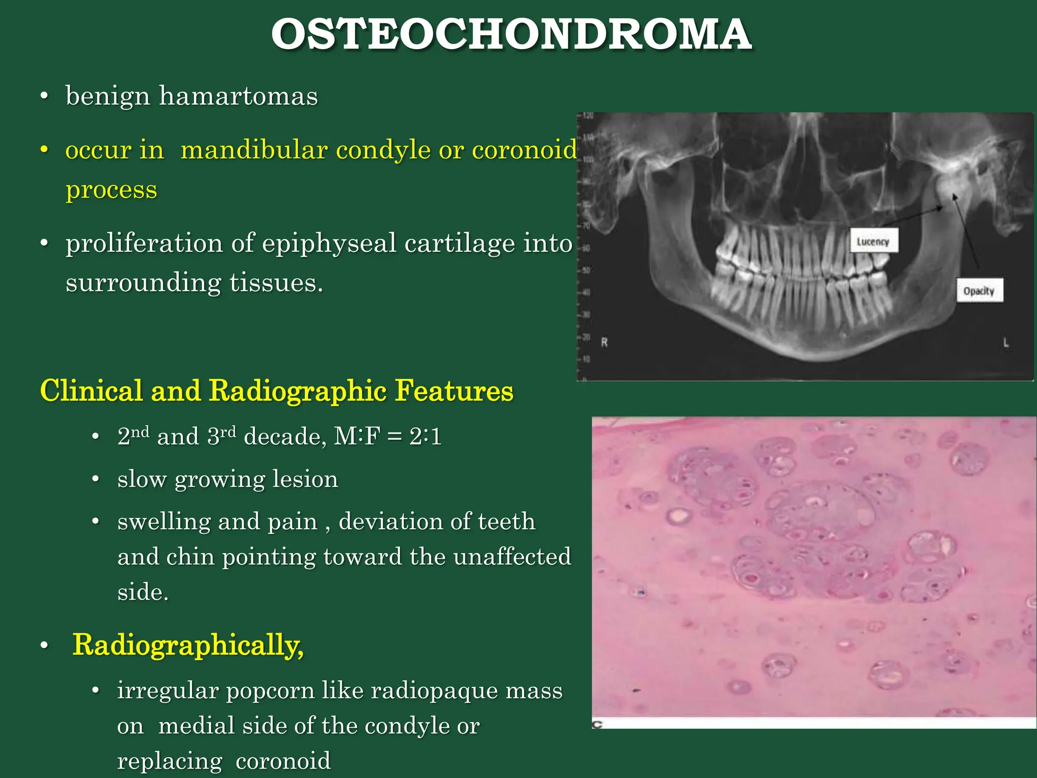 swelling_of_jaw_and_surgery_of_mandible_my_ppt.pptx