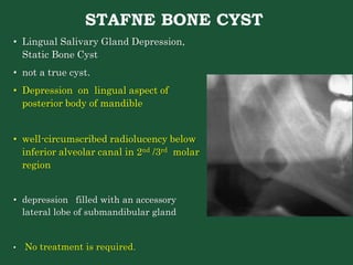 swelling_of_jaw_and_surgery_of_mandible_my_ppt.pptx