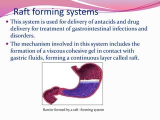 Floating drug delivery system ppt | PPTX