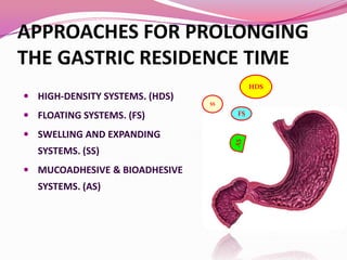 Floating drug delivery system ppt | PPTX