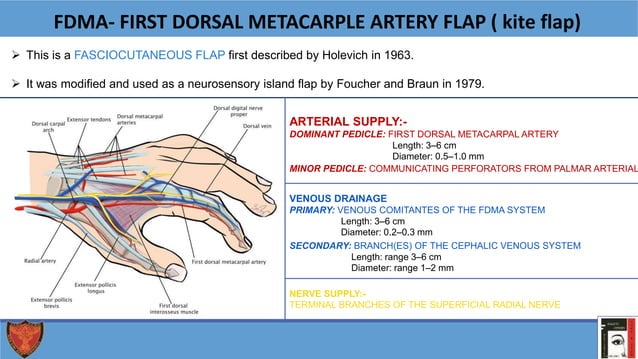 FDMA FLAP - The first dorsal metacarpal artery (FDMA) flap is used ...