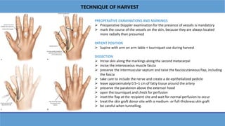FDMA FLAP - The first dorsal metacarpal artery (FDMA) flap is used ...