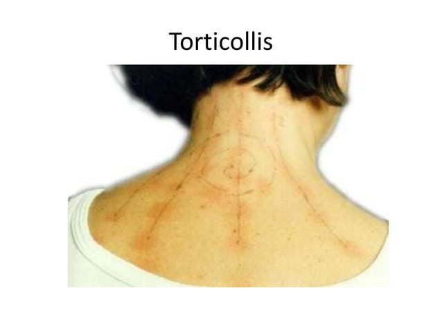 Rebox current | PPT | First Aid | Injuries