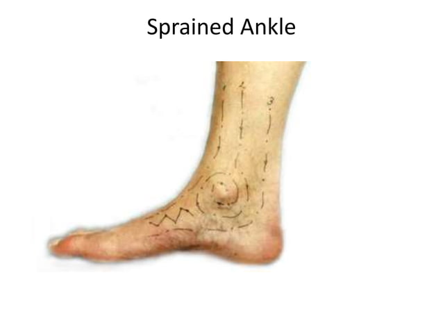 Rebox current | PPT | First Aid | Injuries