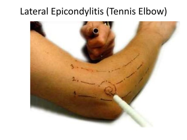 Rebox current | PPT | First Aid | Injuries